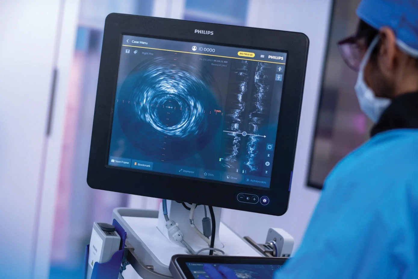 Philips Volcano - LX Concept